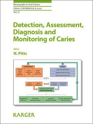 Detection, Assessment, Diagnosis, and Monitoring of Caries by Nigel ...