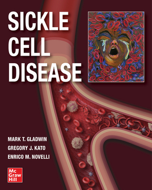 Sickle Cell Disease by Gregory Kato, Mark T. Gladwin, Enrico Novelli ...